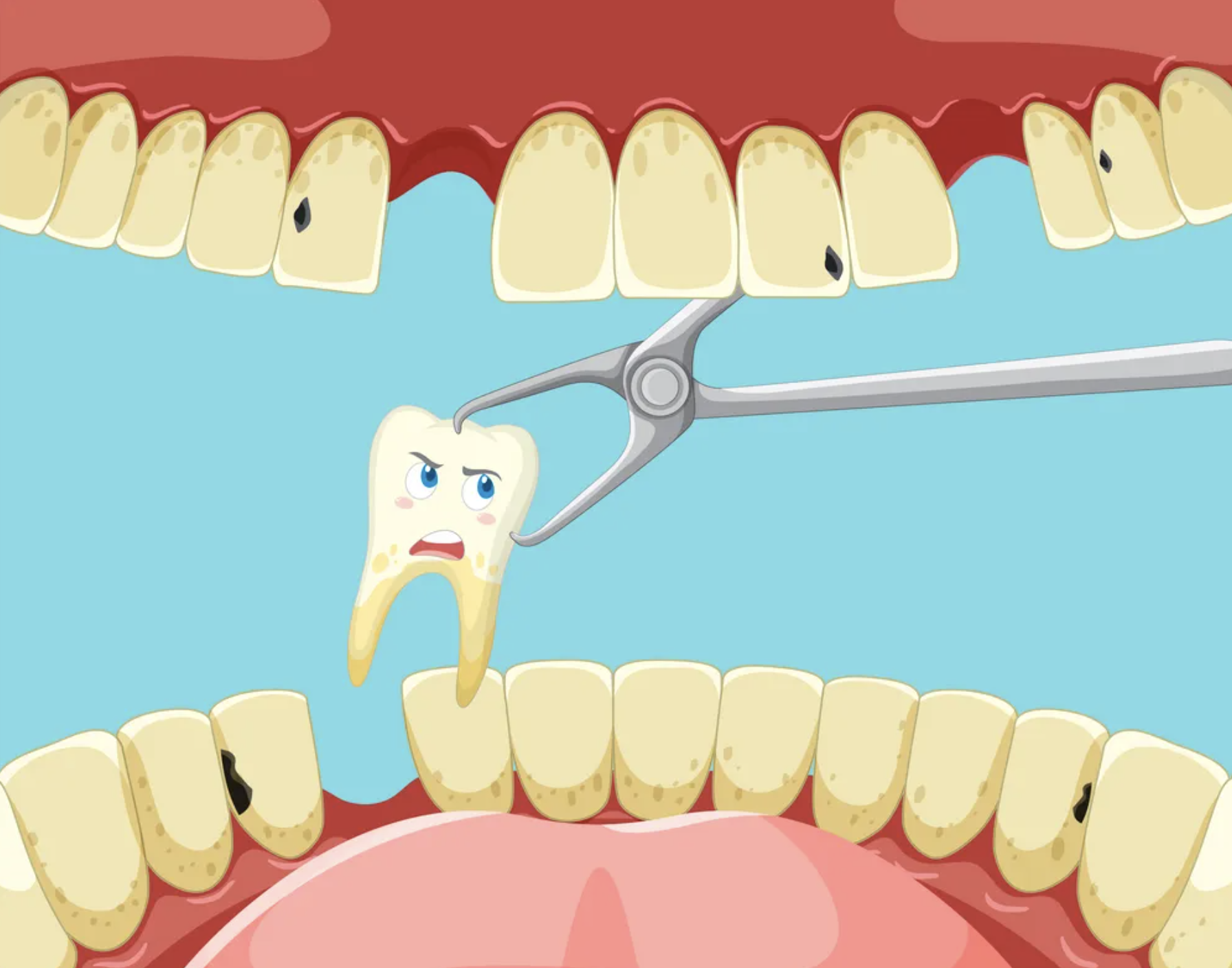 Everything You NEED To Know About Removing a Tooth | Pasqua South ...
